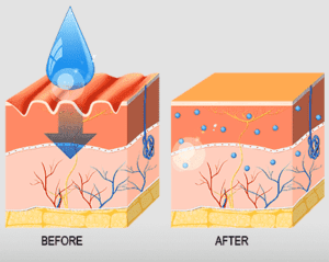 8 Fun Facts about Botox - Esteem Medical Clinic 至尊医美