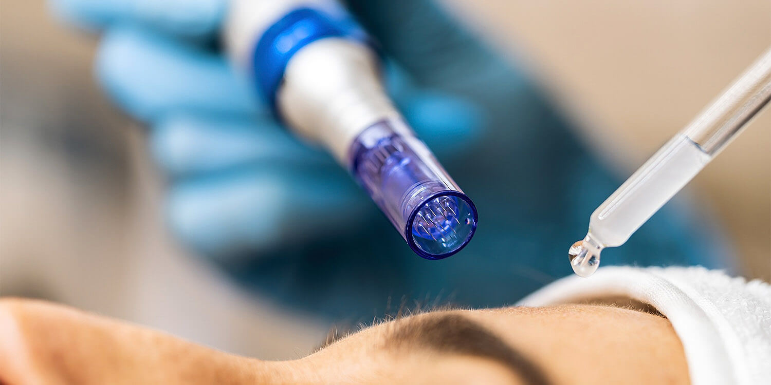 Microneedling in Dubai | Dermapen Microneedling Treatment